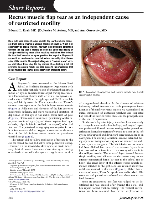 (PDF) Rectus muscle flap tear as an independent cause of restricted ...