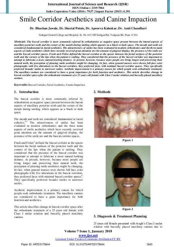 (PDF) Smile Corridor Aesthetics and Canine Impaction