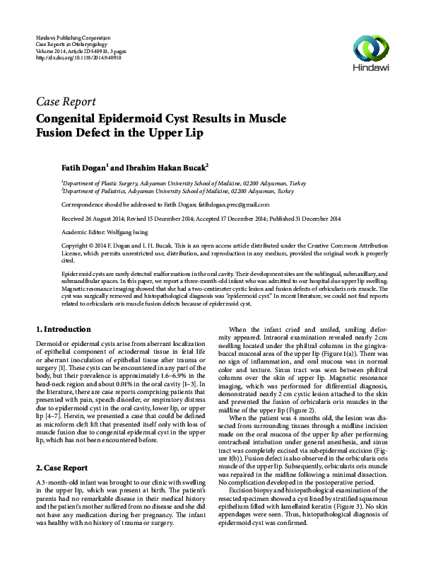 (PDF) Congenital Epidermoid Cyst Results in Muscle Fusion Defect in the ...
