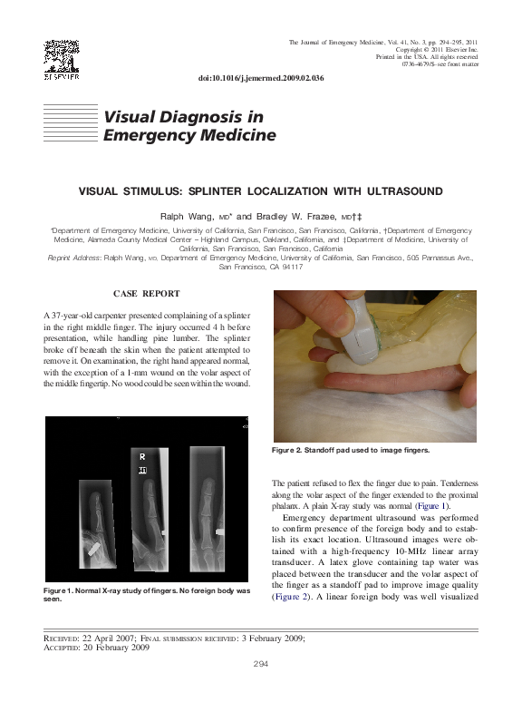 (PDF) Visual Stimulus: Splinter Localization with Ultrasound | Ralph ...