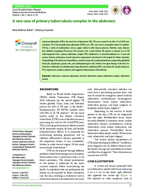 (PDF) A rare case of primary tuberculosis complex in the abdomen