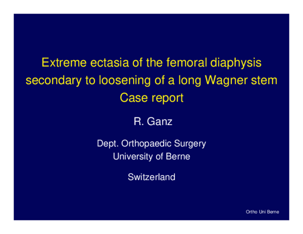 (PDF) Extreme Ectasia of the Femoral Diaphysis Secondary to Loosening ...