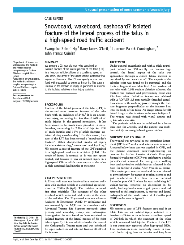(PDF) Snowboard, wakeboard, dashboard? Isolated fracture of the lateral ...