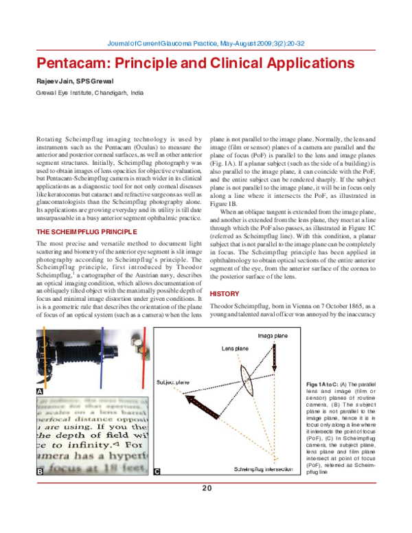 (PDF) Pentacam: Principle and Clinical Applications
