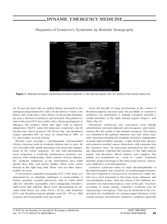 (PDF) Diagnosis of Lemierre’s Syndrome by Bedside Sonography