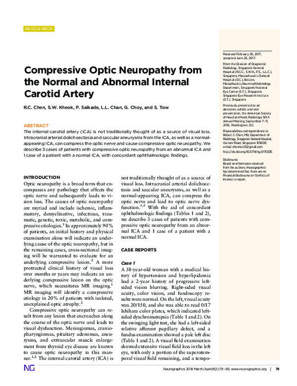 Compressive Optic Neuropathy from the Normal and Abnormal Internal ...