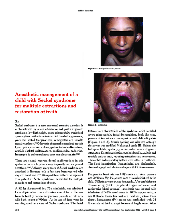(PDF) Anesthetic management of a child with Seckel syndrome for ...