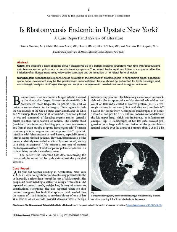(PDF) Is Blastomycosis Endemic in Upstate New York?