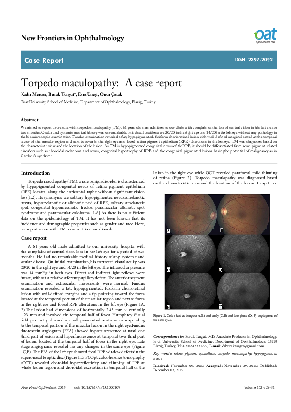 (PDF) Torpedo maculopathy: A case report