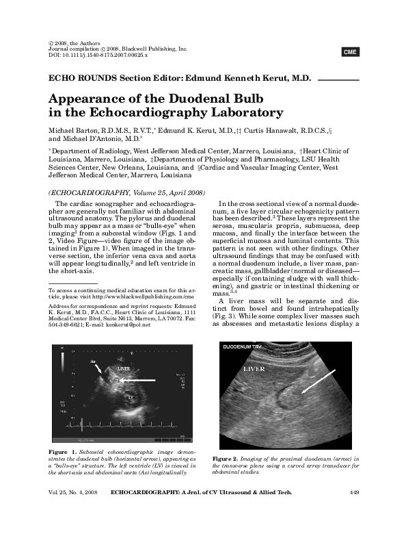 (PDF) Appearance of the Duodenal Bulb in the Echocardiography Laboratory