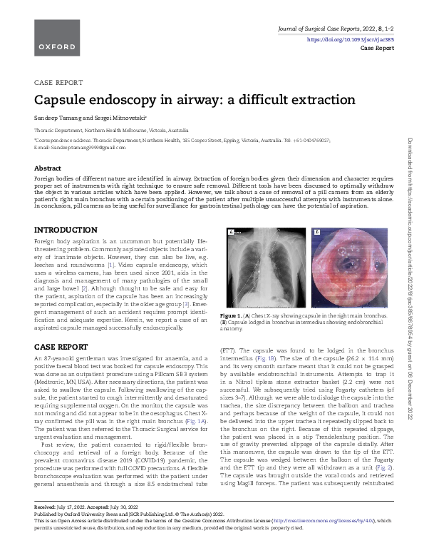 (PDF) Capsule endoscopy in airway: a difficult extraction