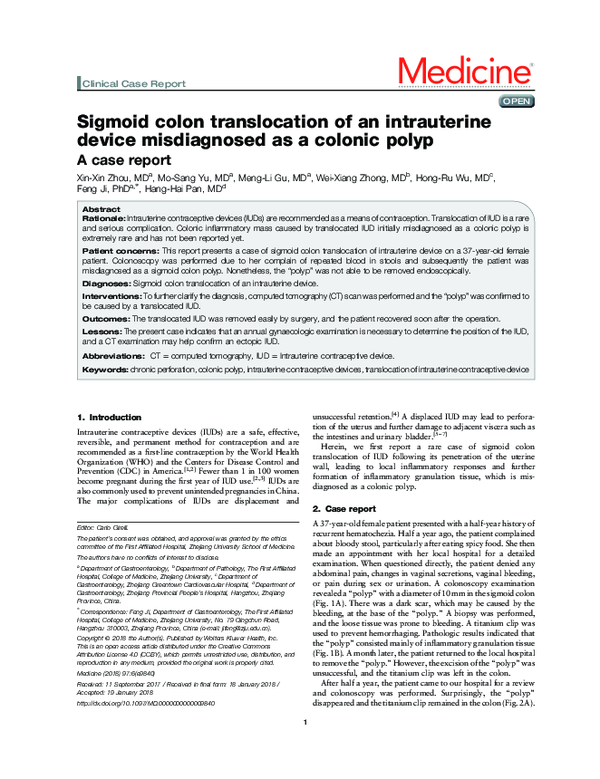 Pdf Sigmoid Colon Translocation Of An Intrauterine Device Misdiagnosed As A Colonic Polyp