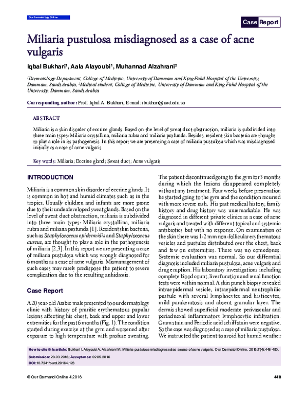 (PDF) Miliaria pustulosa misdiagnosed as a case of acne vulgaris