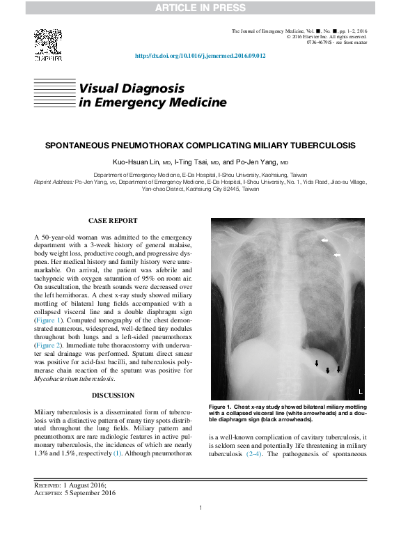 (PDF) Spontaneous Pneumothorax Complicating Miliary Tuberculosis
