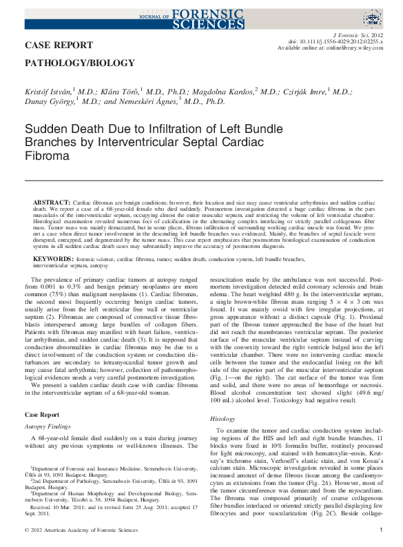 (PDF) Sudden Death Due to Infiltration of Left Bundle Branches by ...