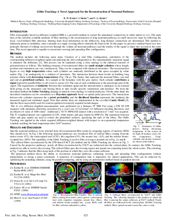 (PDF) Gibbs tracking: A novel approach for the reconstruction of ...
