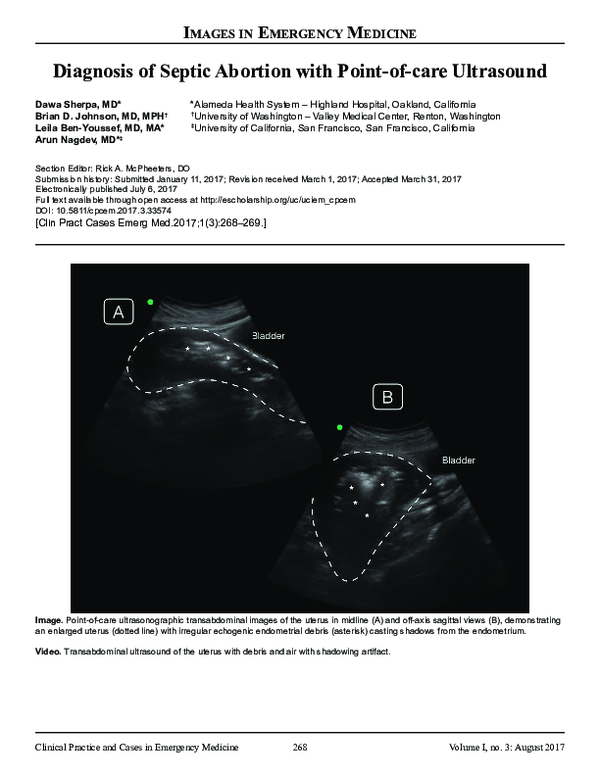 (PDF) Diagnosis of Septic Abortion with Point-of-care Ultrasound