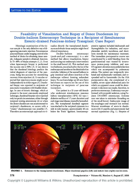 (PDF) Feasibility of Visualization and Biopsy of Donor Duodenum by Double-balloon Enteroscopy ...