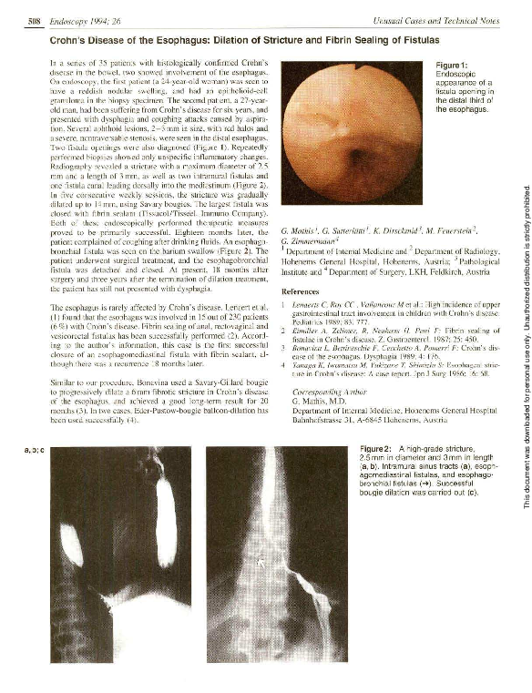 (PDF) Crohn's Disease of the Esophagus: Dilation of Stricture and ...