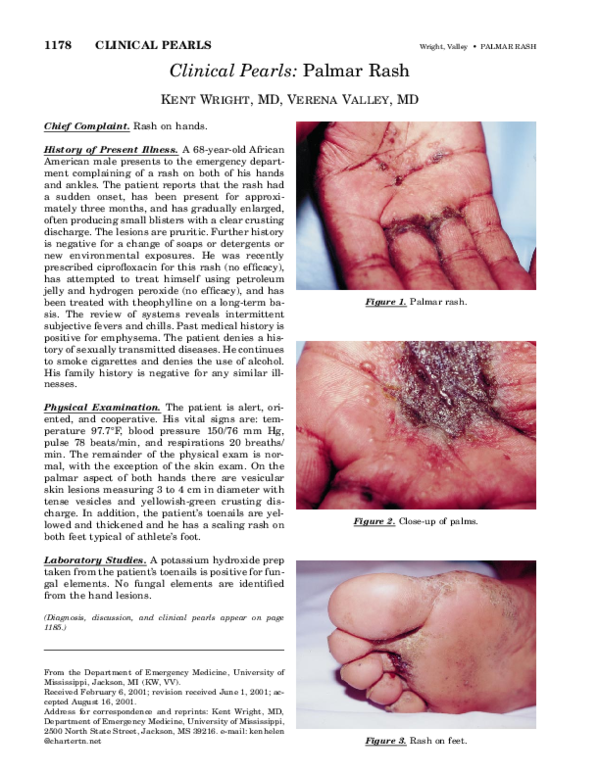 (PDF) Clinical Pearls Palmar Rash