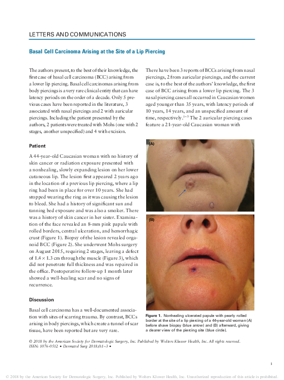 (PDF) Basal Cell Carcinoma Arising at the Site of a Lip Piercing