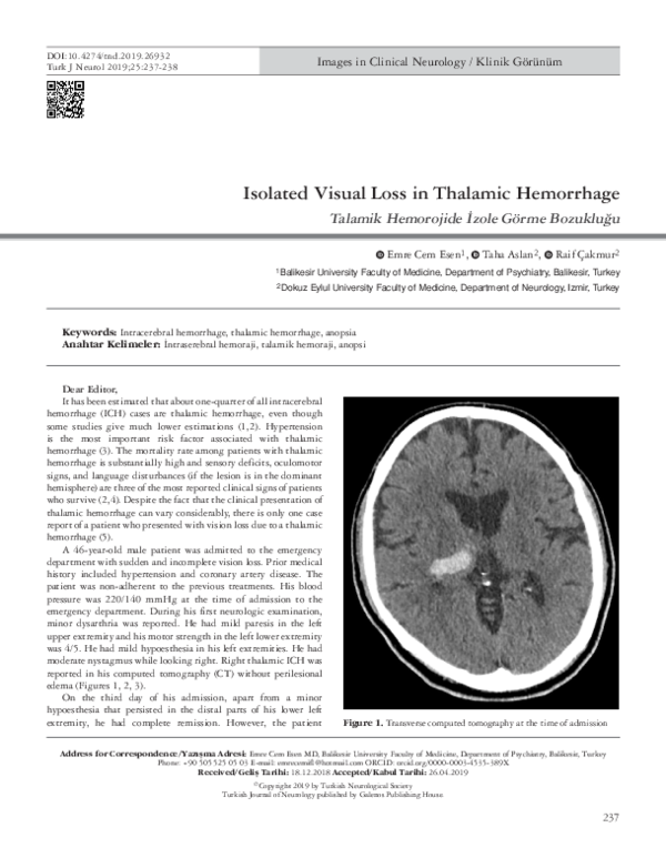 (PDF) Isolated Visual Loss in Thalamic Hemorrhage