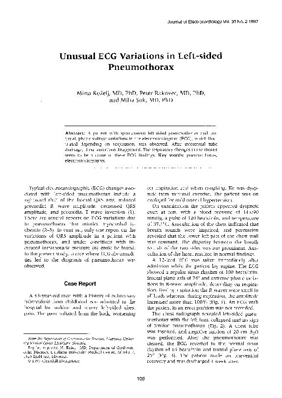 (PDF) Unusual ECG variations in left-sided pneumothorax | Peter Rakovec ...