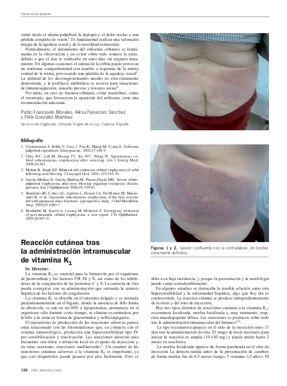 (PDF) Reacción cutánea tras la administración intramuscular de vitamina K1