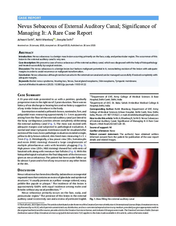 (PDF) Nevus Sebaceous of External Auditory Canal; Significance of ...