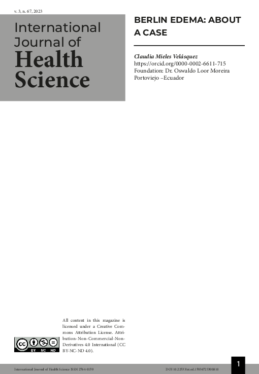 (PDF) Berlin edema: about a case (Atena Editora) | Atena Editora ...