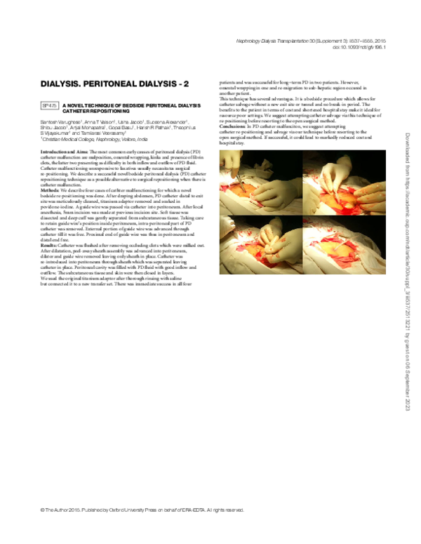 (PDF) SP475A Novel Technique of Bedside Peritoneal Dialysis Catheter Repositioning