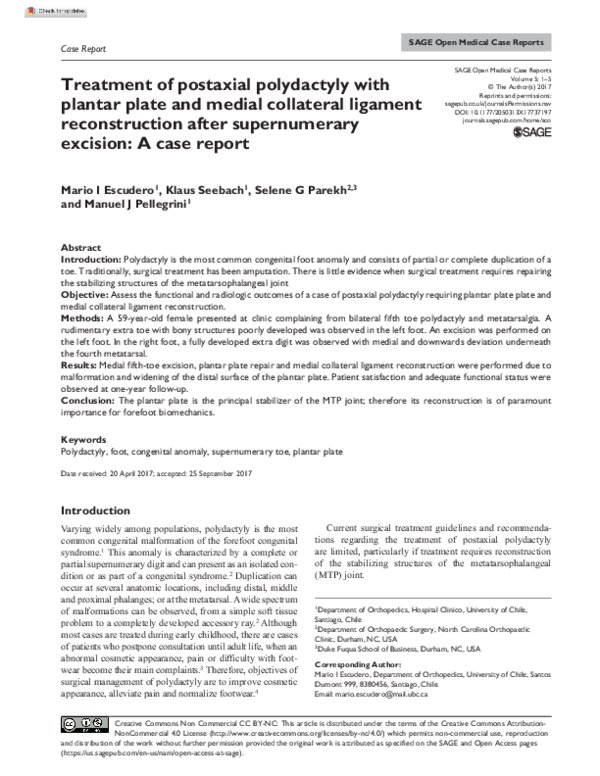 (PDF) Treatment of postaxial polydactyly with plantar plate and medial ...