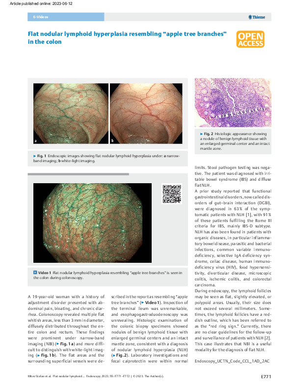 Intestinal Nodular Lymphoid Hyperplasia
