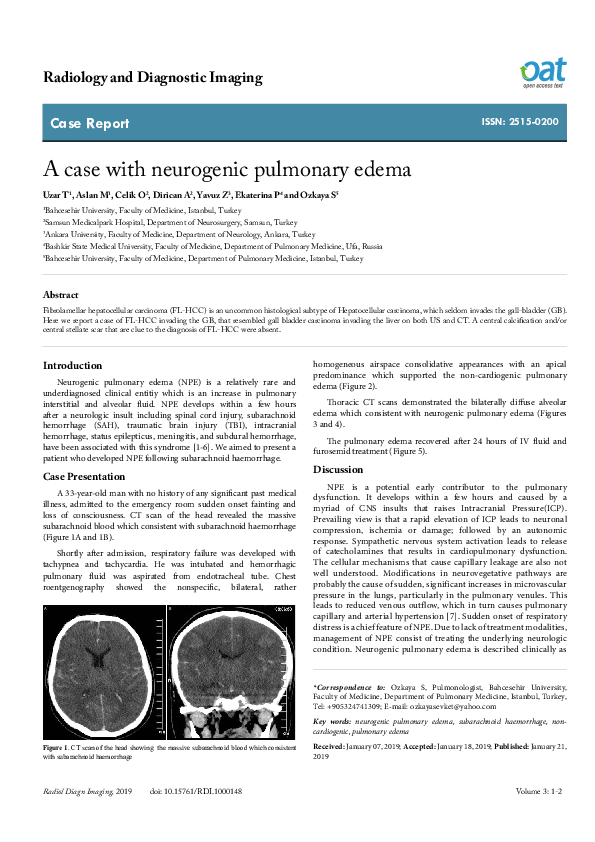 (PDF) A case with neurogenic pulmonary edema | Adem Dirican - Academia.edu
