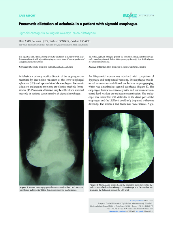 (PDF) Pneumatic dilatation of achalasia in a patient with sigmoid ...