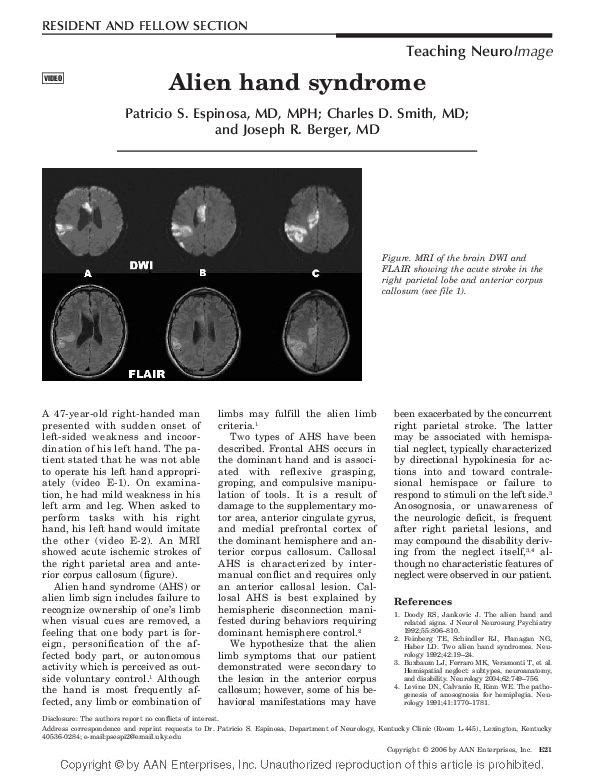 (PDF) Alien hand syndrome