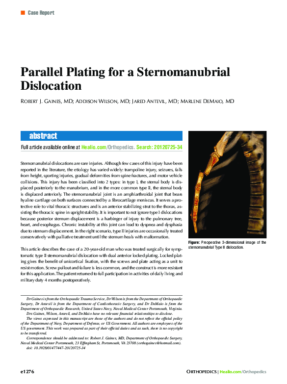 Parallel Plating For A Sternomanubrial Dislocation