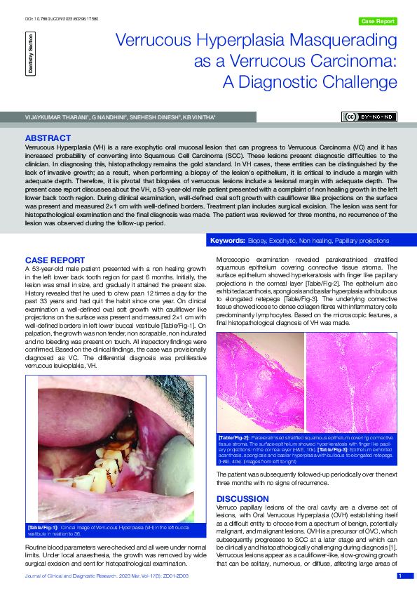 (PDF) Verrucous Hyperplasia Masquerading as a Verrucous Carcinoma: A ...