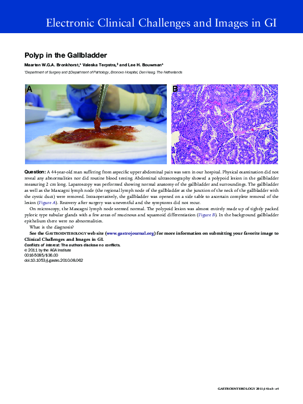 (PDF) Polyp in the Gallbladder
