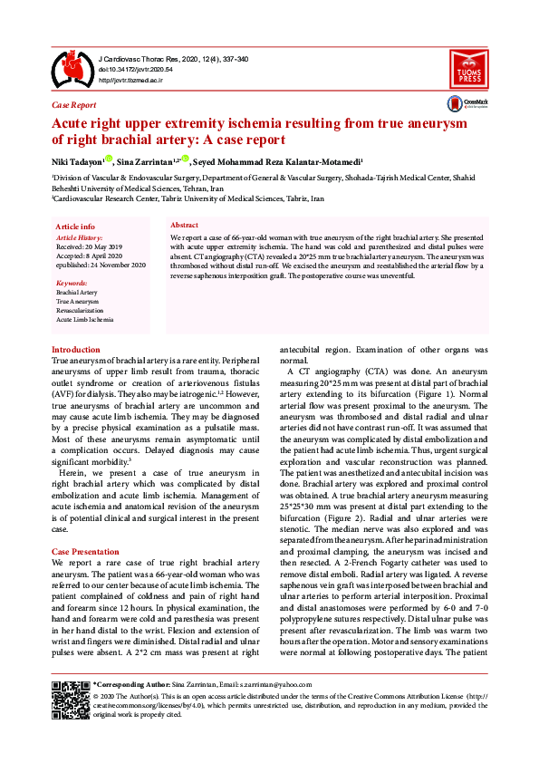 (PDF) Acute right upper extremity ischemia resulting from true ...