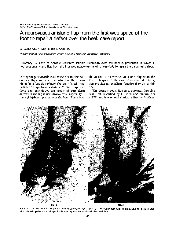 (PDF) A neurovascular island flap from the first web space of the foot ...