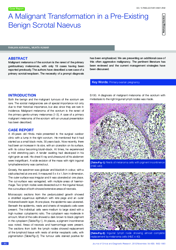 (PDF) A malignant transformation in a pre-existing benign scrotal naevus