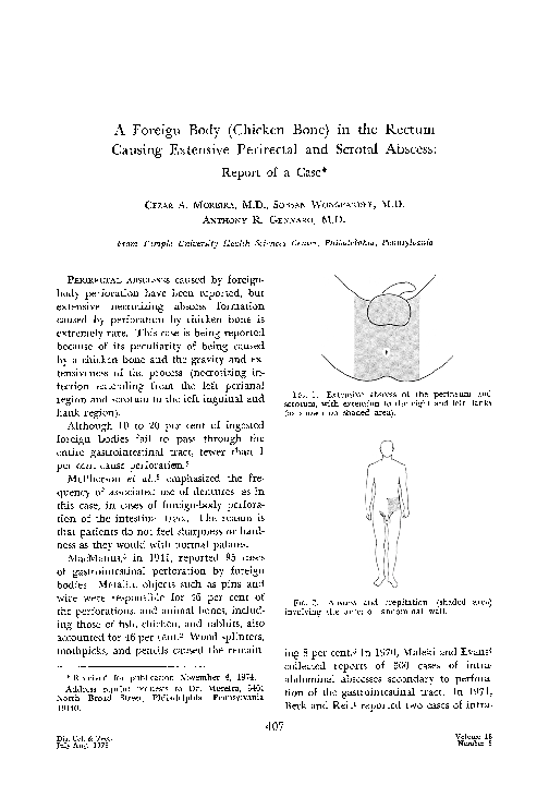 (PDF) A foreign body (chicken bone) in the rectum causing extensive ...