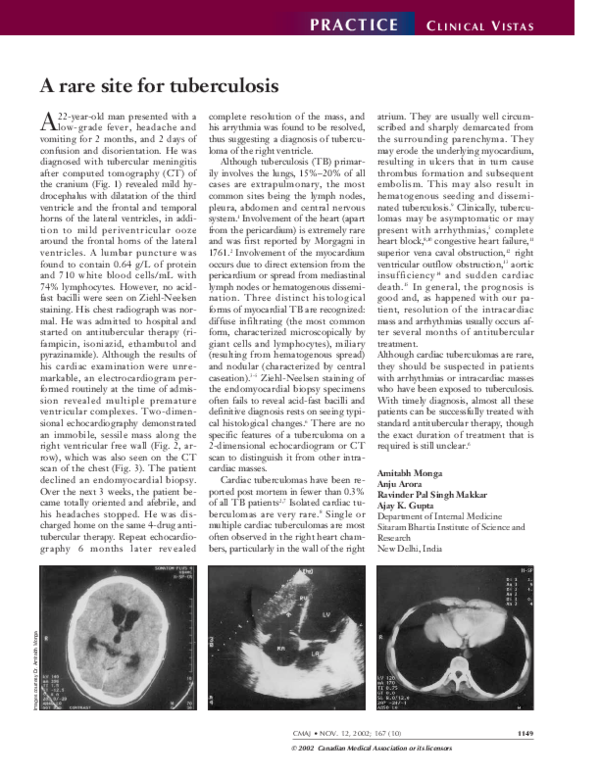 (PDF) A rare site for tuberculosis