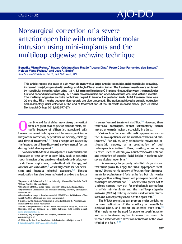 (PDF) Nonsurgical correction of a severe anterior open bite with ...