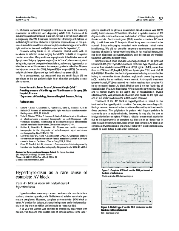 (PDF) Hyperthyroidism as a rare cause of complete AV block