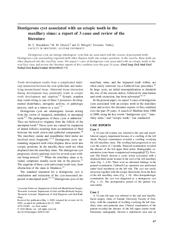(PDF) Dentigerous cyst associated with an ectopic tooth in the ...