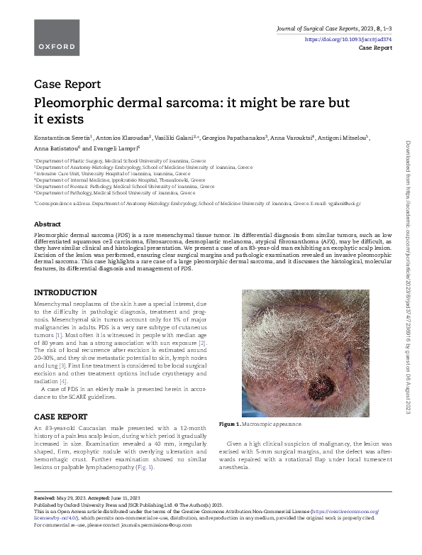 (PDF) Pleomorphic dermal sarcoma: it might be rare but it exists