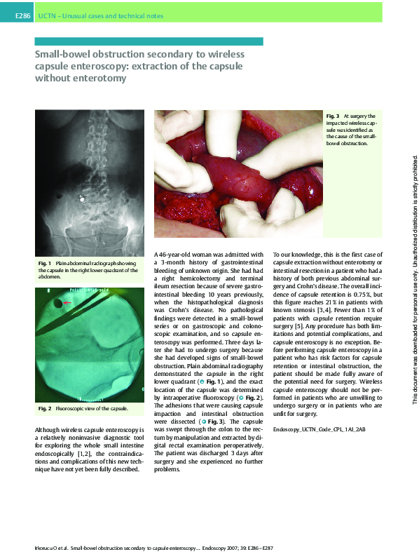 Pdf Small Bowel Obstruction Secondary To Wireless Capsule Enteroscopy Extraction Of The