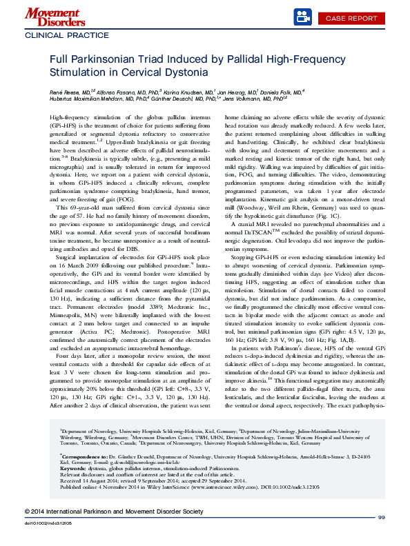 (PDF) Full Parkinsonian Triad Induced by Pallidal High-Frequency ...